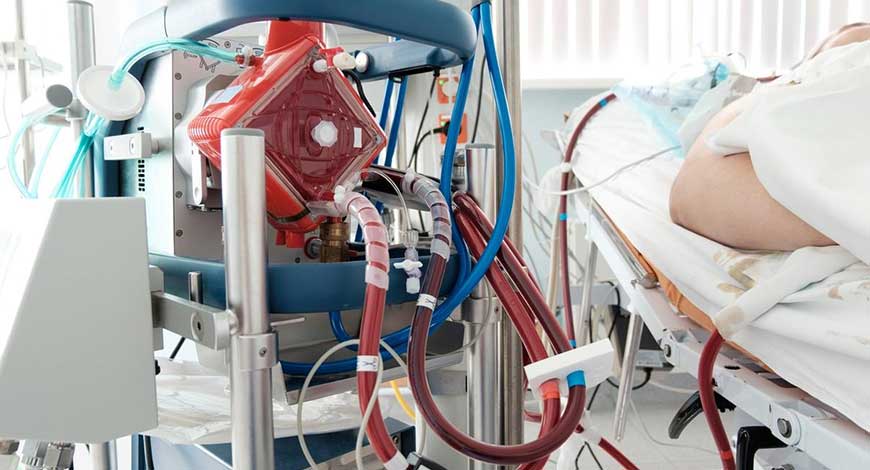 New study reveals ECMO mortality remains high - Medical Buyer