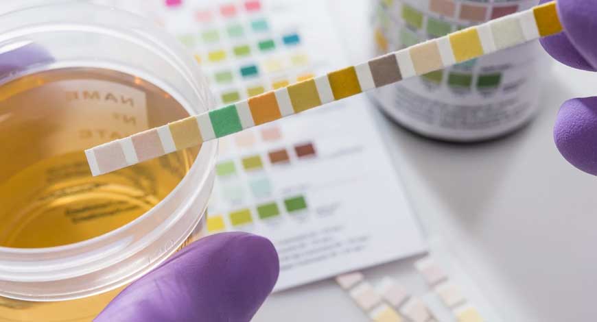 UTI testing market to hit USD 78.9B - Medical Buyer