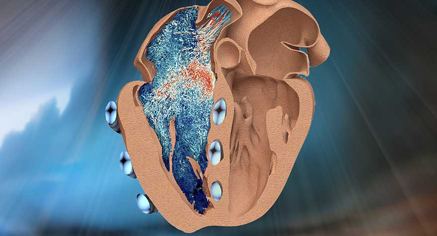 Decoding new soft robotic heart - Medical Buyer